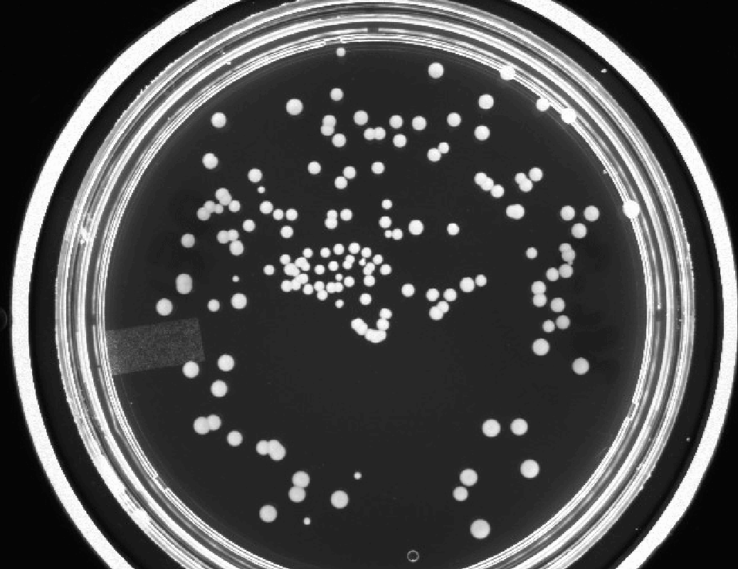 Drop Counting with CircleSegmentor – TordivelBlog